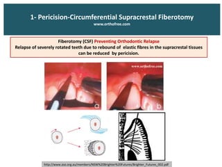 interdisciplinary treatment in orthodontics dr olivier sandid ...