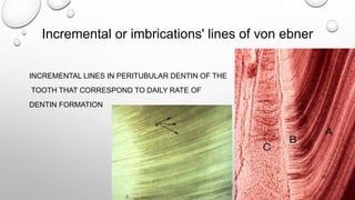 Incremental Lines Of Von Ebner