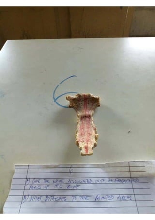 The steeplechase exam in Human Anatomy practical | PDF