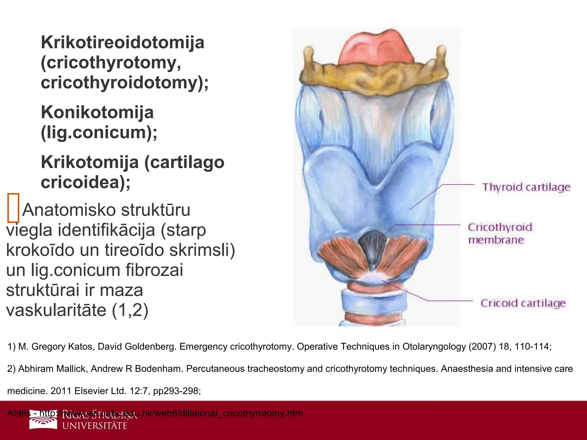 krikotireoidotomija, konikotomija, krikotomija | PPT