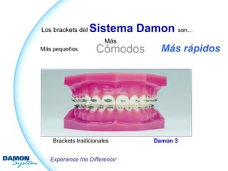 El Sistema Damon | PPS