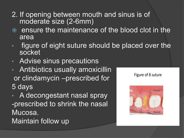 Oro antral communication | PPTX | Ear, Nose and Throat Conditions ...