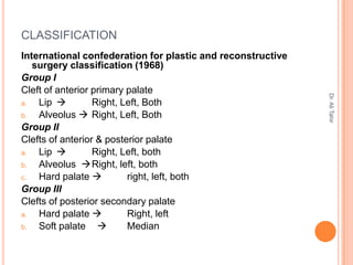 Oro facial clefts | PPTX