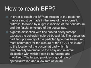 Oro – antral communication | PPTX