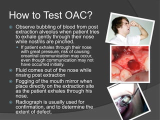 Oro – antral communication | PPTX