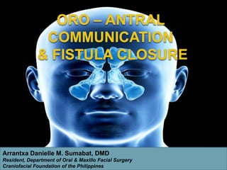Oro – antral communication | PPT