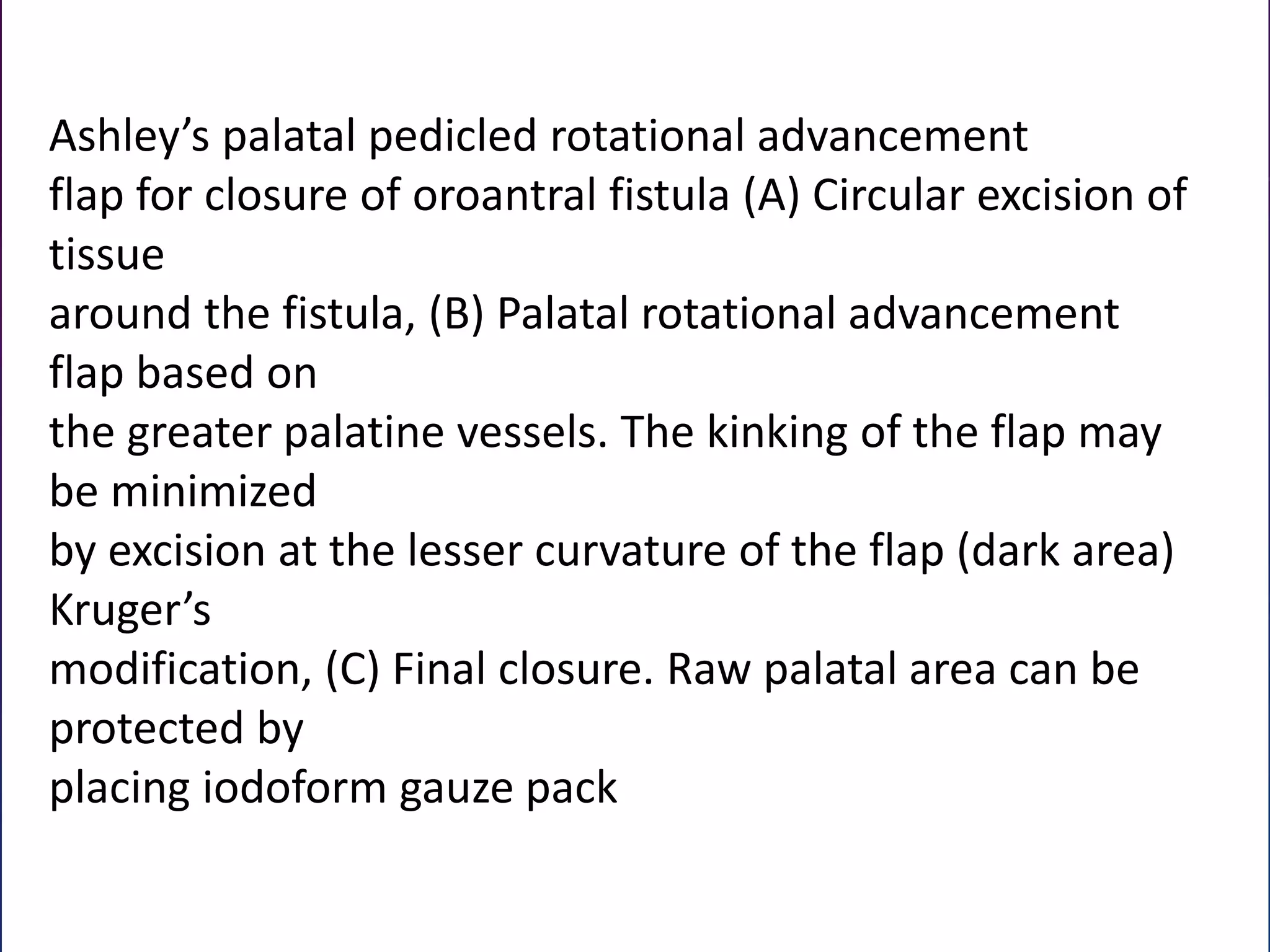 Oroantral communication & fistula | PPTX