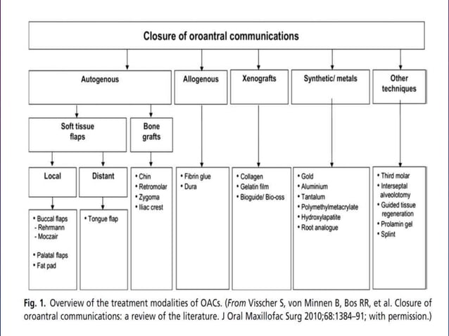 Oroantral communication & fistula | PPTX