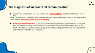 Oroantral Communications.pptx‌ dental surgery | PPTX | Ear, Nose and ...