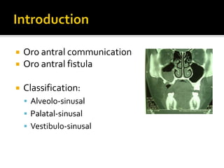 Oro antral fistula repair | PPTX