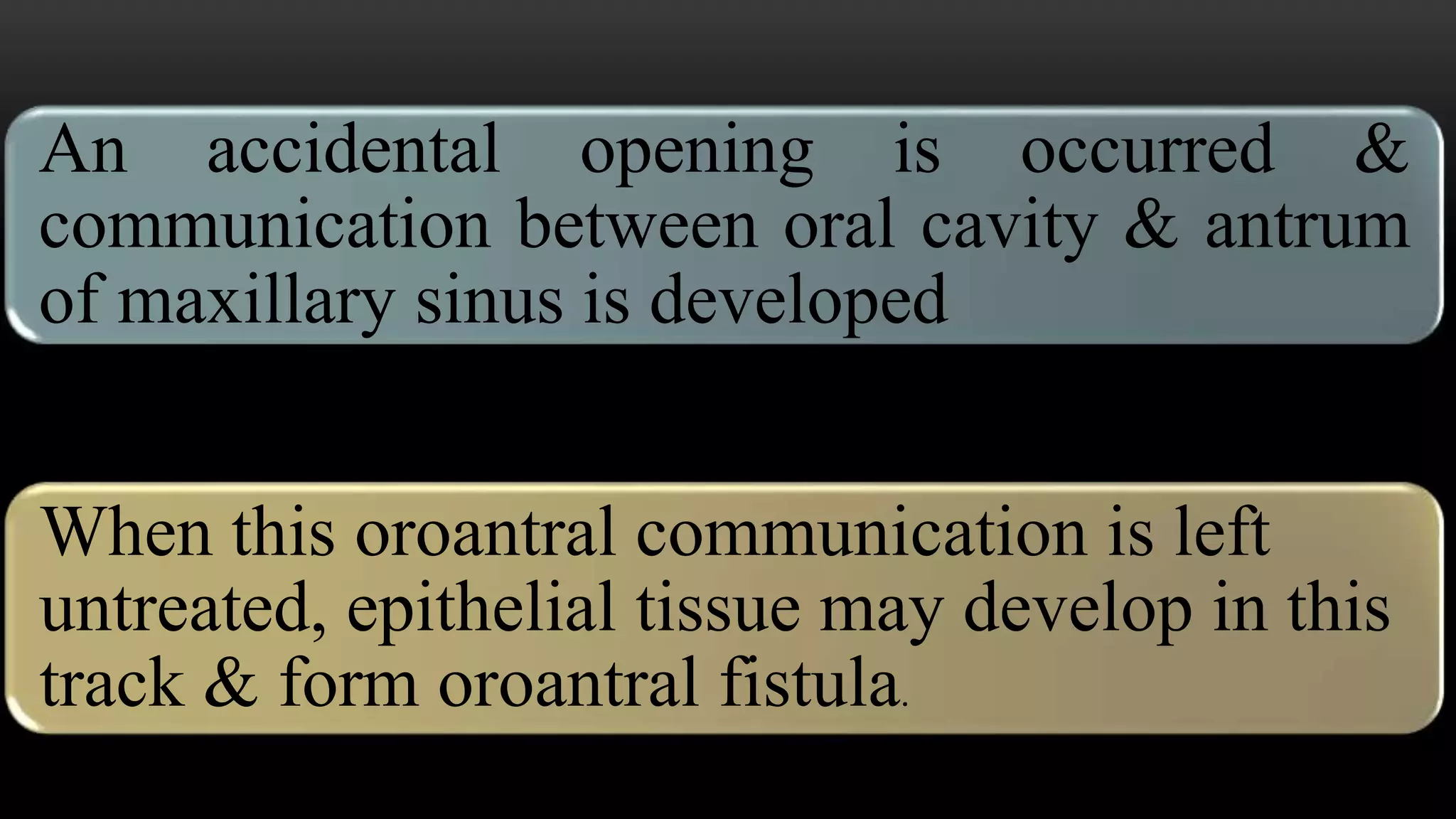 Oroantral fistula | PPTX