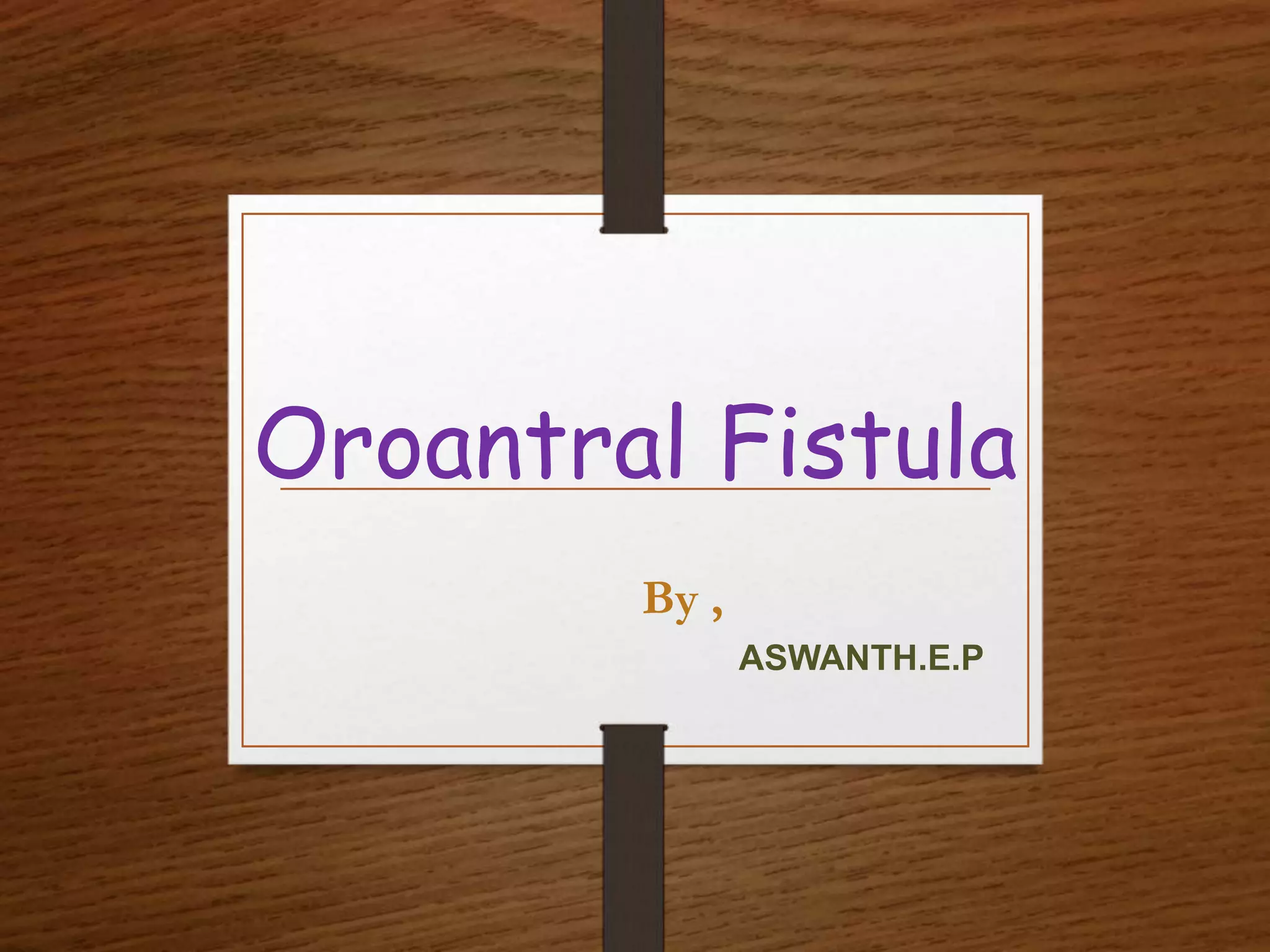 Oroantral fistula | PPTX