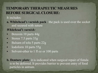 Oroantral Fistula | PPTX