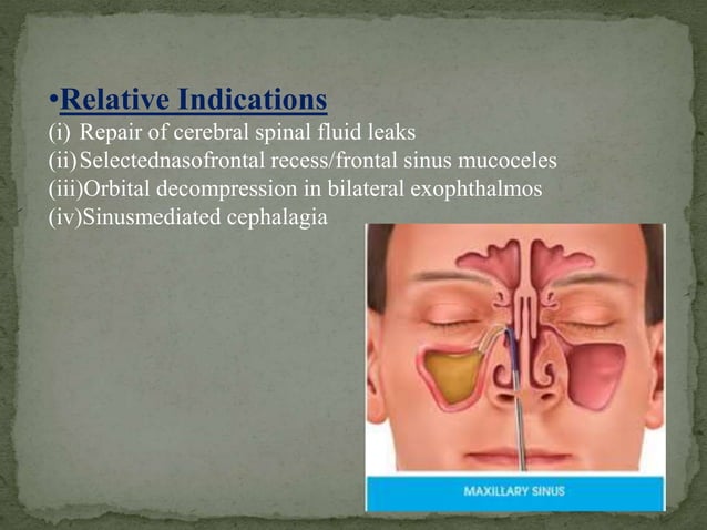 Oroantral Fistula | PPTX | Ear, Nose and Throat Conditions | Diseases ...