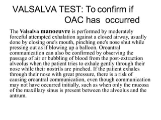 oroantral fistula mohamad.pptx