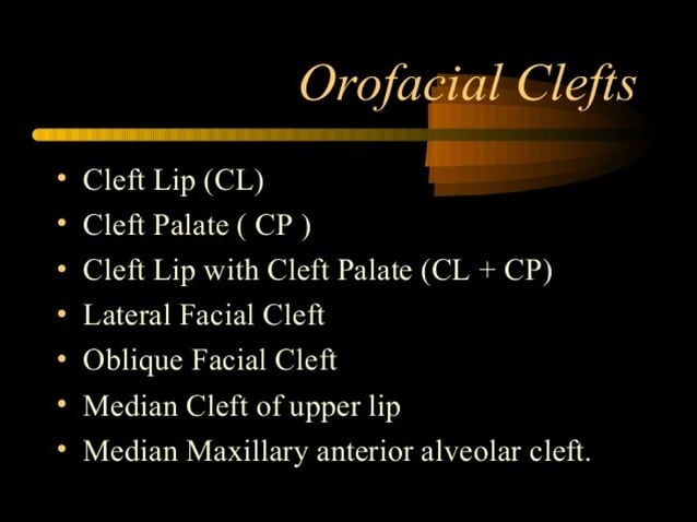 Orofacial clefts | PPT