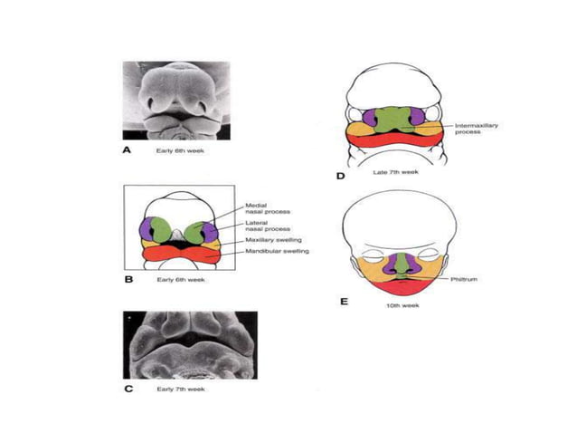 Orofacial development | PPTX | Ear, Nose and Throat Conditions ...