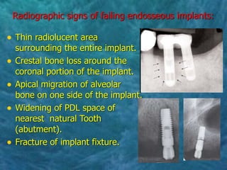 Orofacial implant | PPT