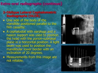 Orofacial implant | PDF