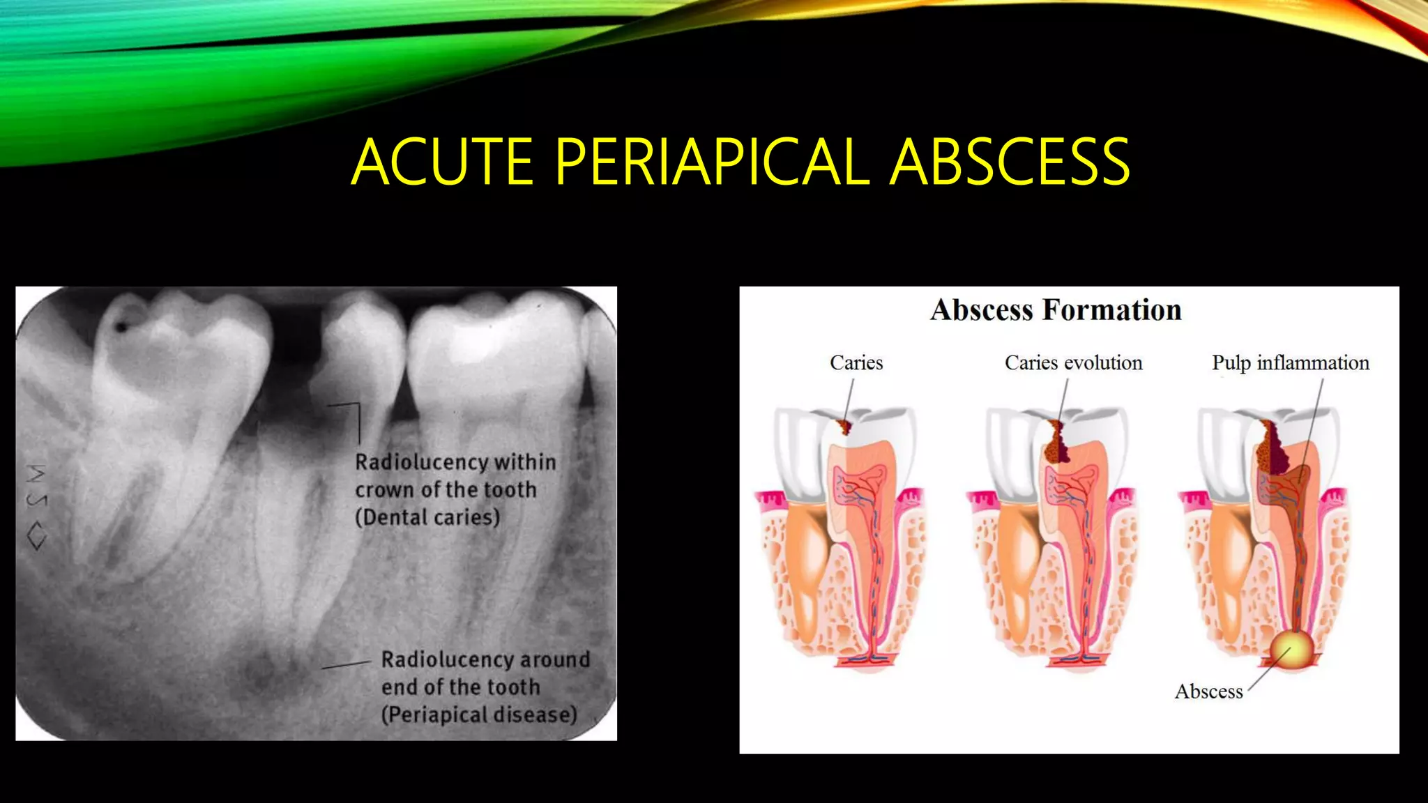Orofacial infection part 1 | PPTX
