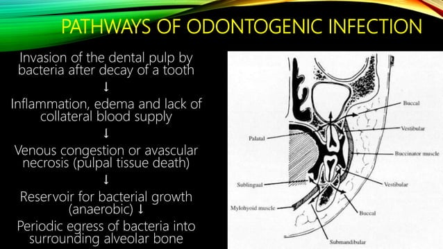 Orofacial infection part 1 | PPTX | Ear, Nose and Throat Conditions ...