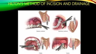 Orofacial infection part 1 | PPT