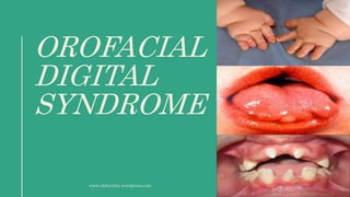 Oral Facial Digital Syndrome