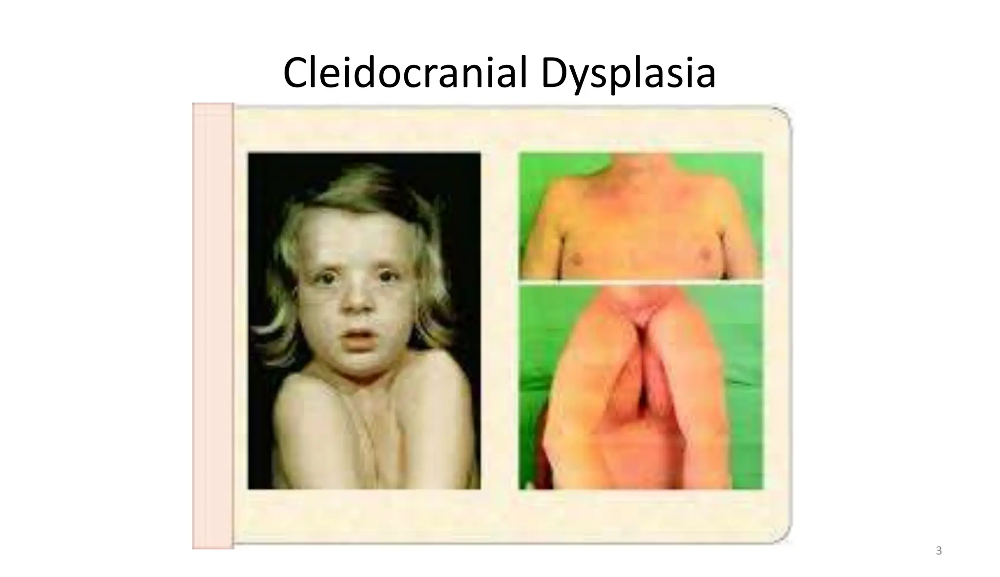 Orofacial Syndromes pathology ver2.pptx