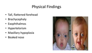 Orofacial Syndromes pathology ver2.pptx