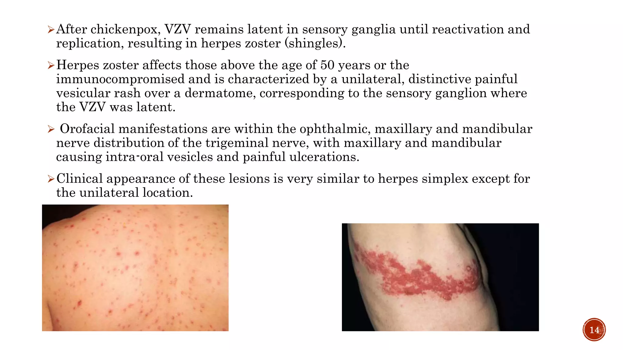 Orofacial viral infections | PPTX