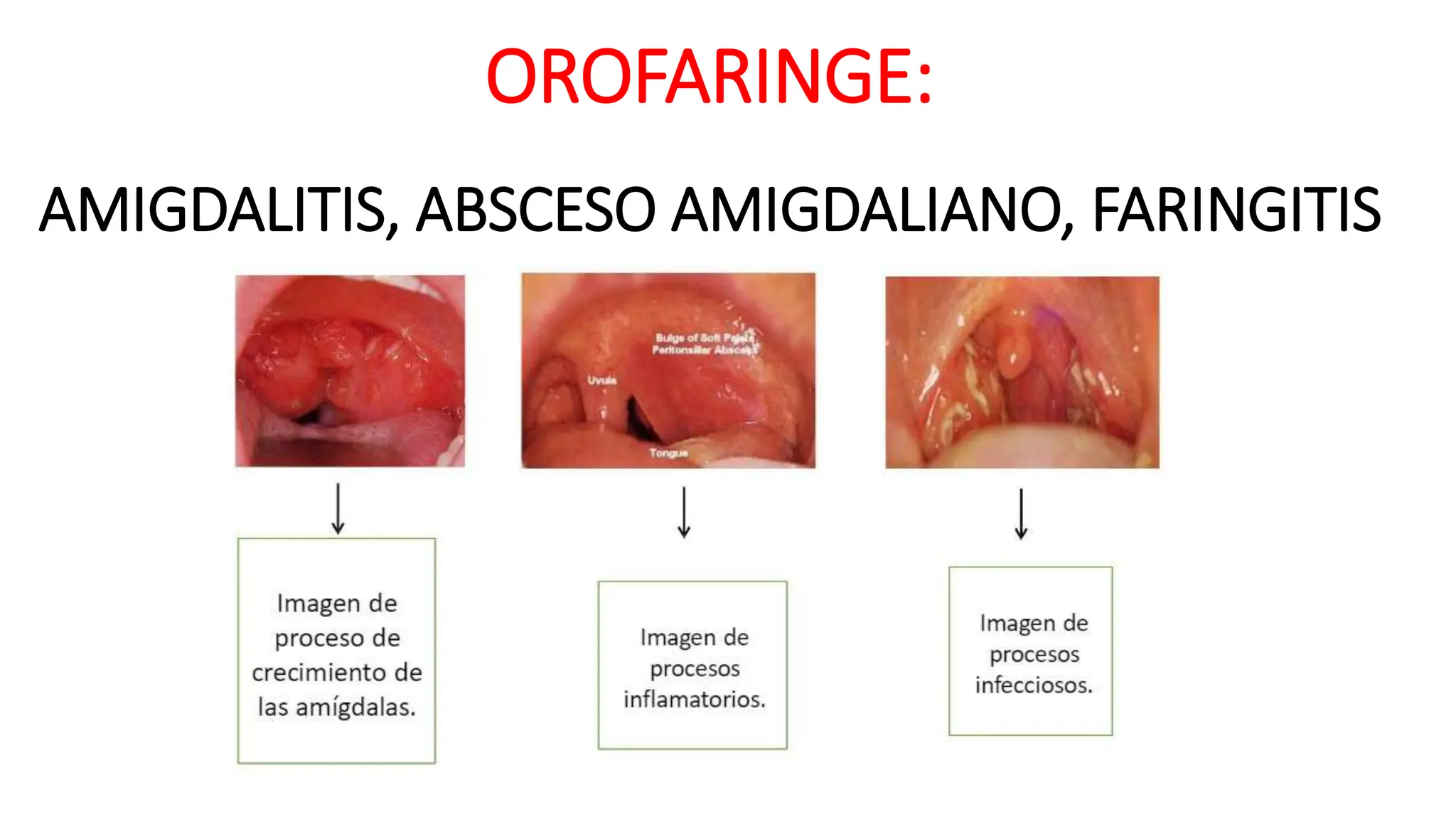 tema: otorrinonaringología - orofaringe. | PPT