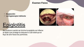 Orofaringe Laringe y Tiroides, examen físico | PPTX