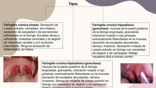 Orofaringe Laringe y Tiroides, examen físico | PPTX