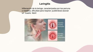 Orofaringe Laringe y Tiroides, examen físico | PPTX