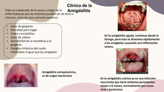 Orofaringe Laringe y Tiroides, examen físico | PPTX