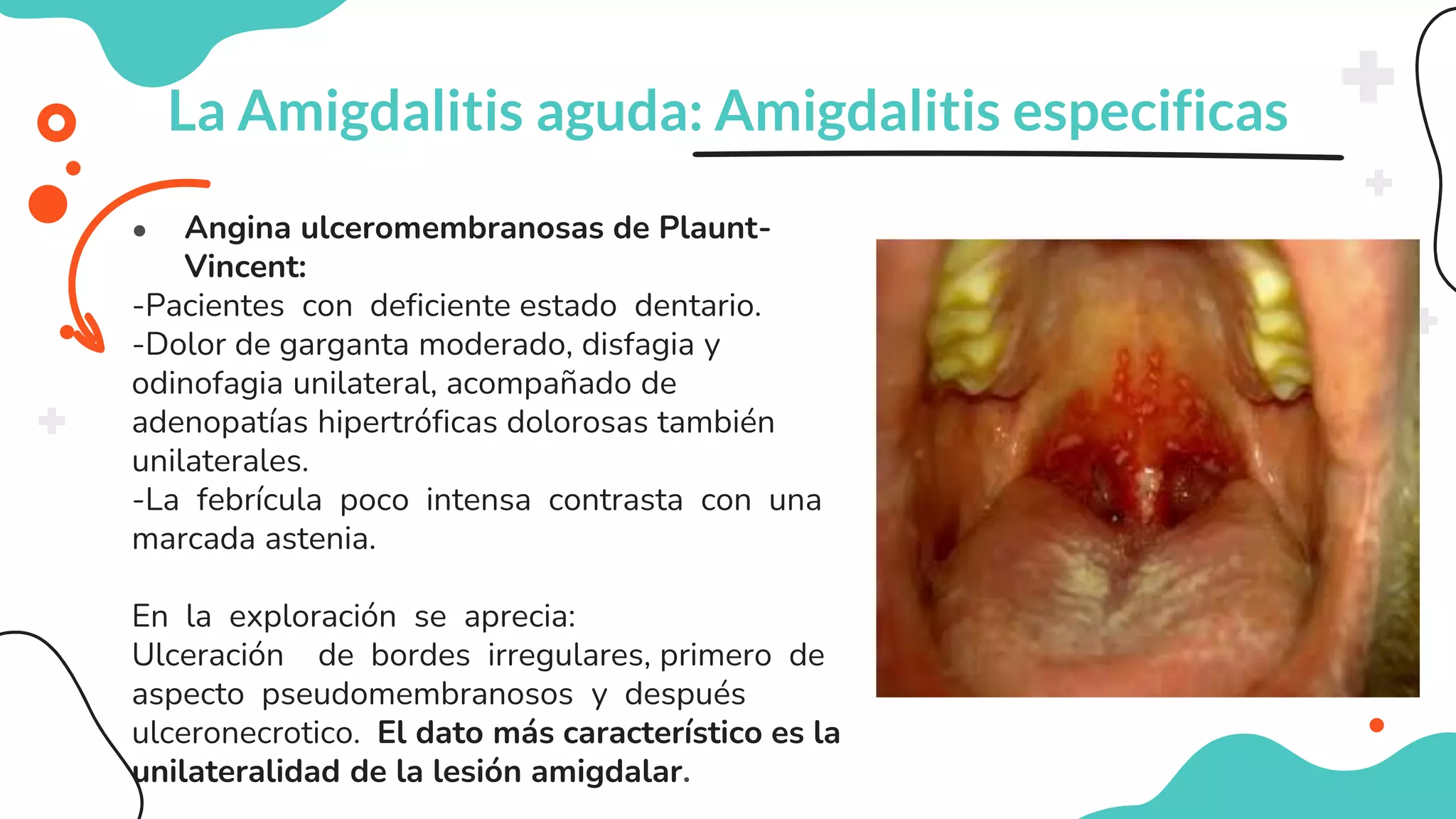orofaringe y laringofaringe.pdf