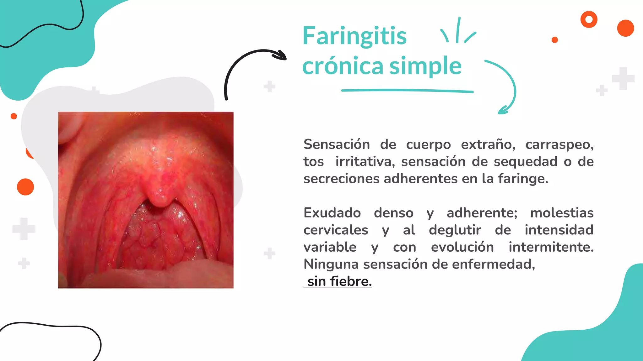 orofaringe y laringofaringe.pdf