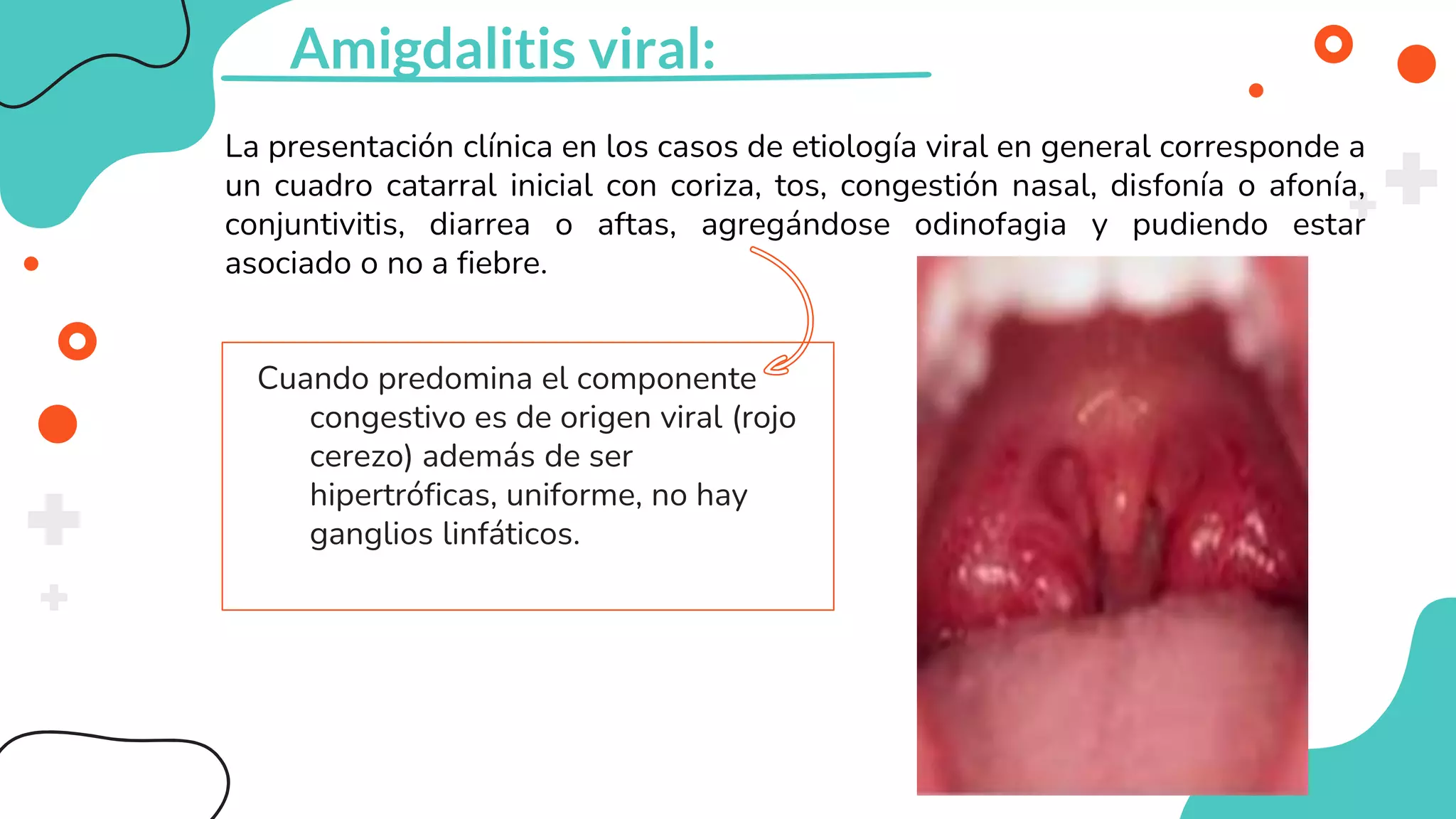 orofaringe y laringofaringe.pdf