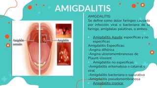 orofaringe y laringofaringe.pdf