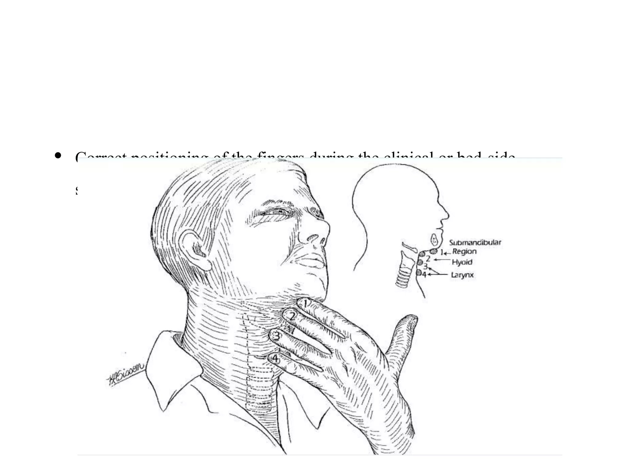 Oromotor rehabilitationppt.pptx