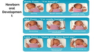 Oro motor stimulation for new born | PPT