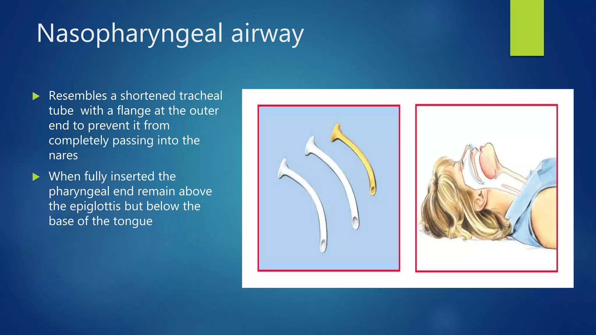 Oropharyngeal airway and nasopharyngeal airway_114337 (1).pptx