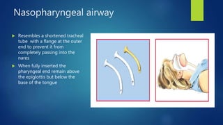 Oropharyngeal airway and nasopharyngeal airway_114337 (1).pptx