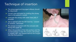 Oropharyngeal airway and nasopharyngeal airway_114337 (1).pptx