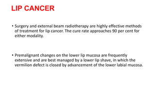 Oropharyngeal cancer | PPTX