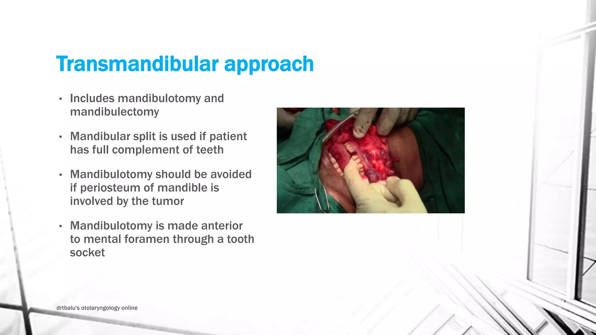Oropharyngeal tumorsslideshare | PPTX