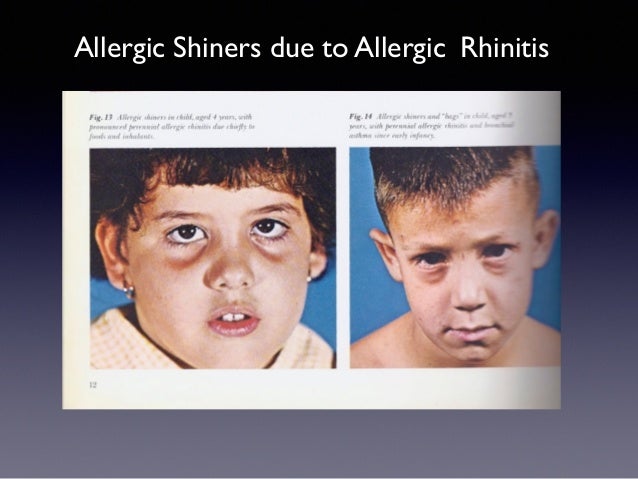 O'Rourke spreecast 11 9-15