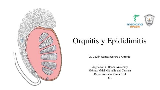 Orquitis y Epididimitis
