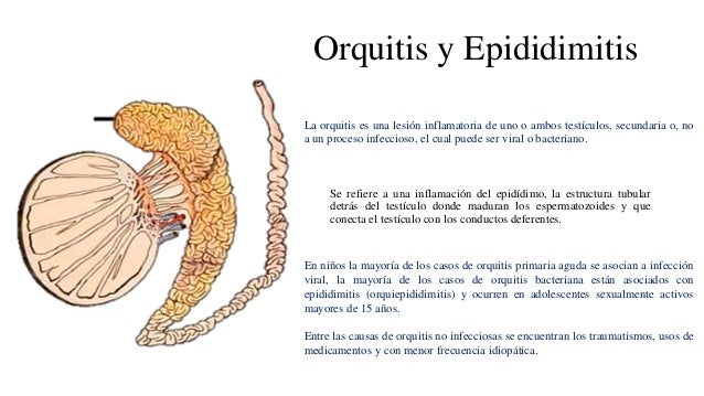 Orquitis y Epididimitis