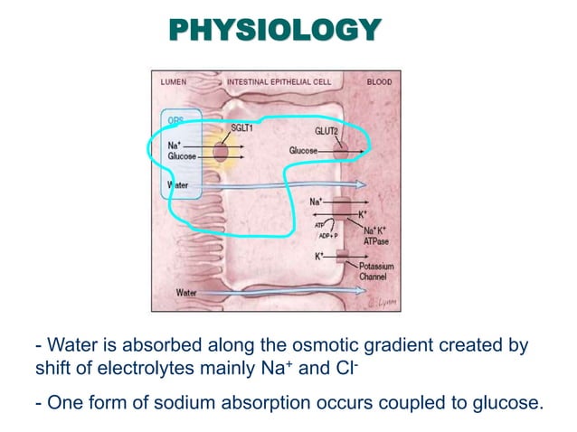 ORS and IV Fluids(Handout) (7).ppsx | Blood Disorders | Diseases and ...